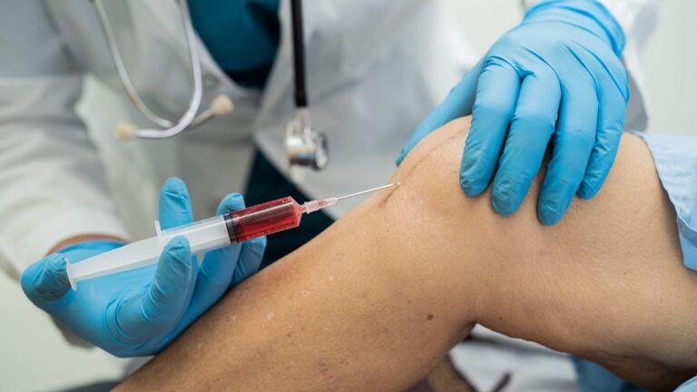 PRP Therapy for Joint Pain: Natural Healing Solutions